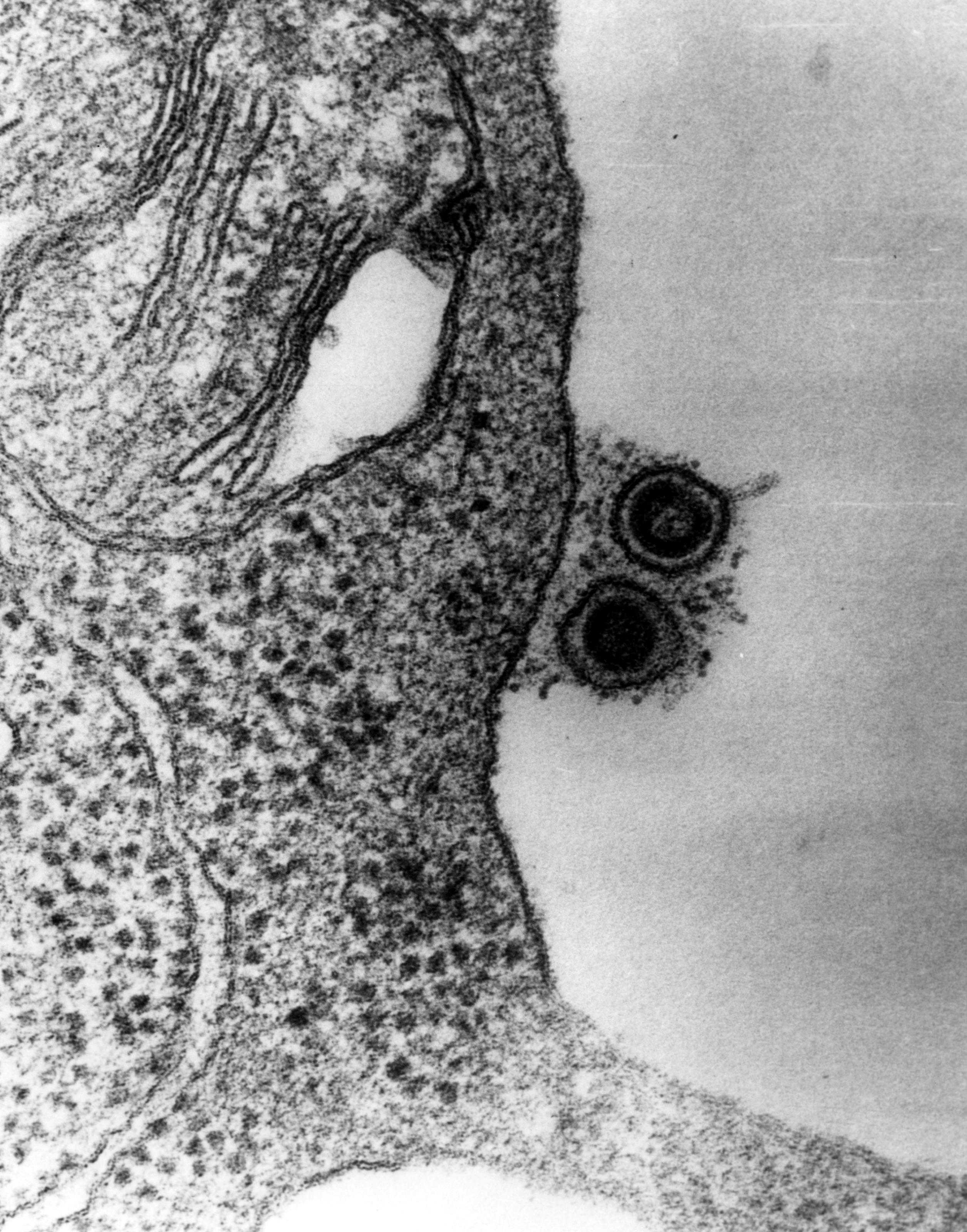 Tupanvirus: virus en la frontera de lo vivo - Hidden Nature
